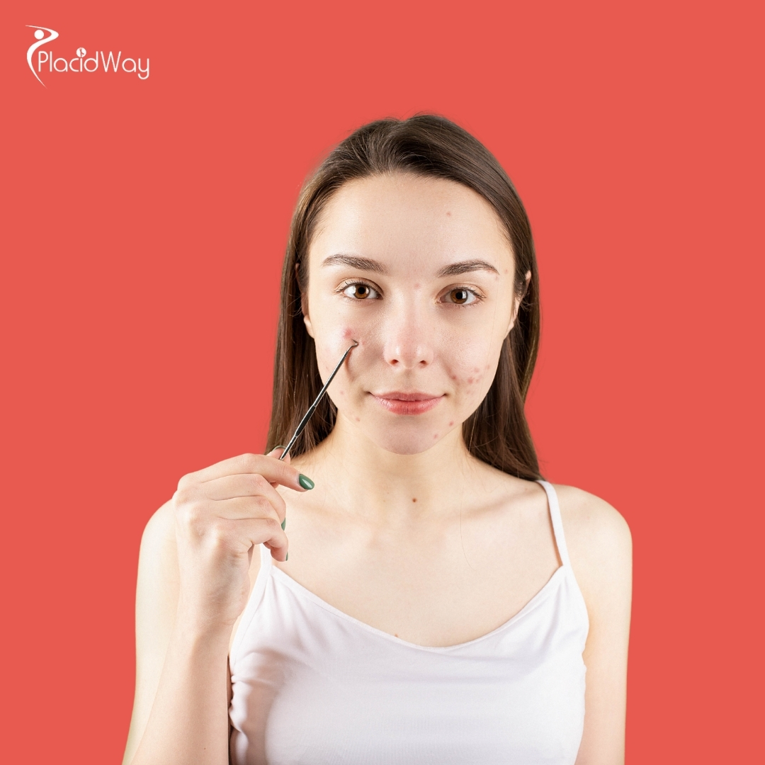 Forehead Bone Reduction Surgery Thailand